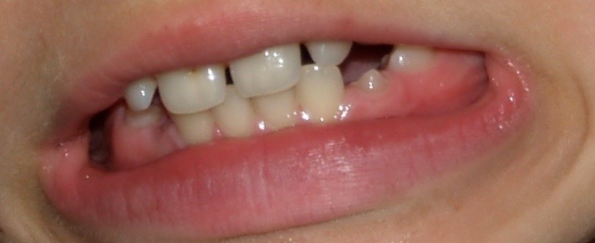 Die Zahnversicherung | Steffi Heck und Hans-Jürgen Krebs